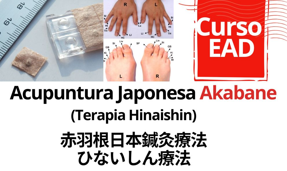 Curso EAD Acupuntura Japonesa Akabane - Instituto Saúde e Equilíbrio